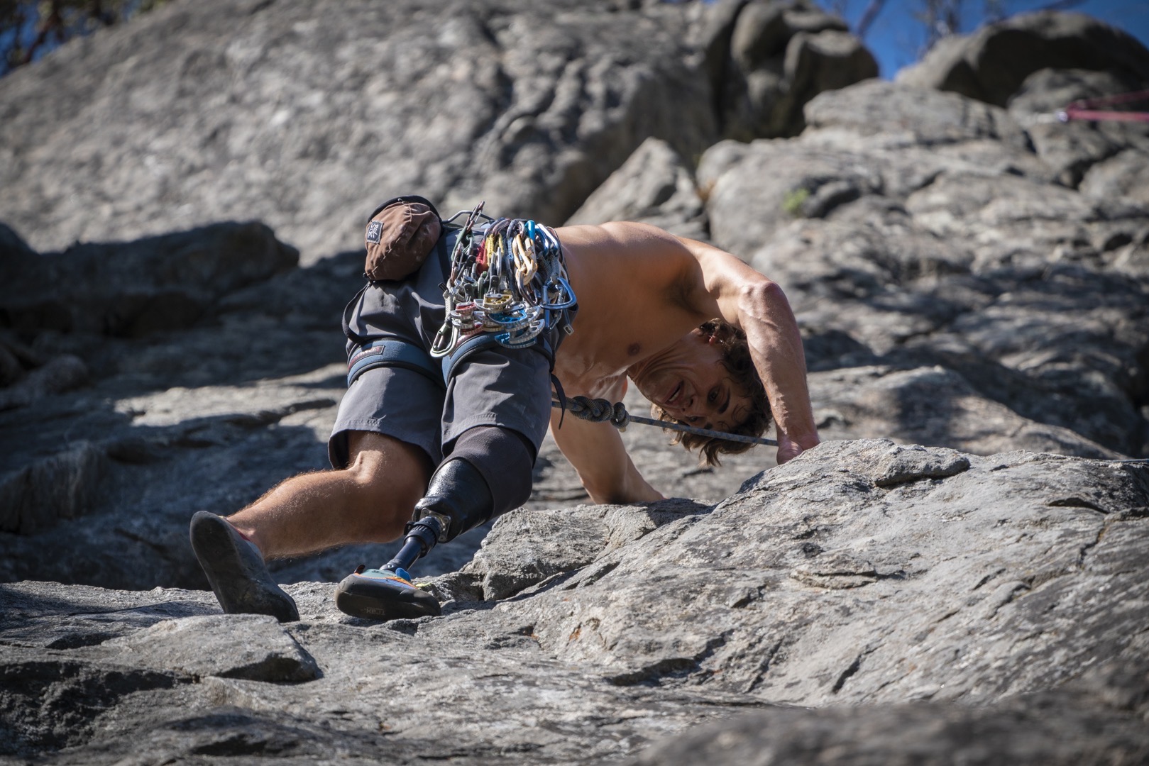 Amputee of the Month Awareness Program - Synergy DMEPOS